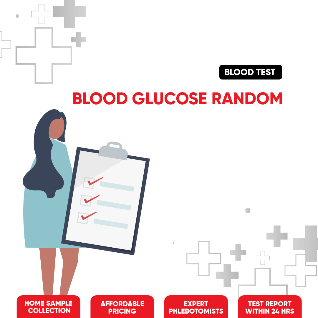 Blood Glucose Random Test – Find My Doctor