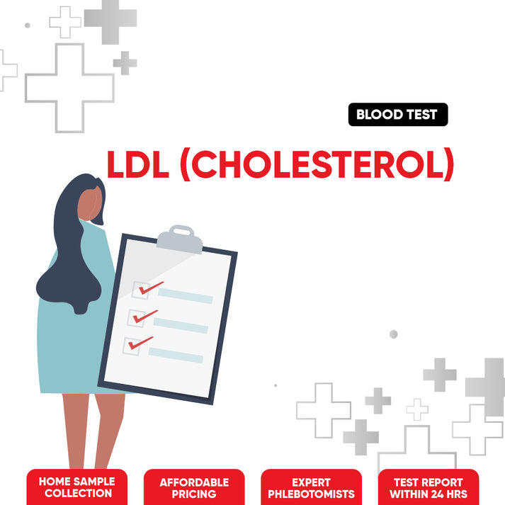 LDL (Cholesterol) Test – Find My Doctor