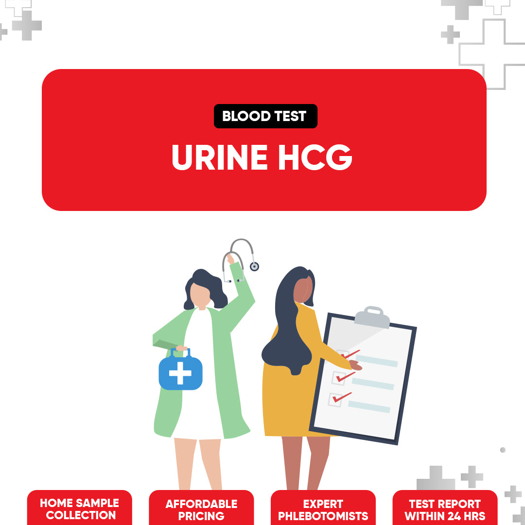 Urine HCG Test – Find My Doctor