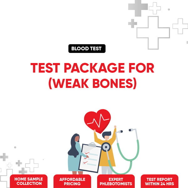 Test Package For Weak Bones – Find My Doctor